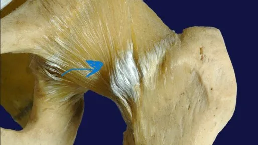 Role of the iliofemoral ligament in hip joint disease | Point of Care ...